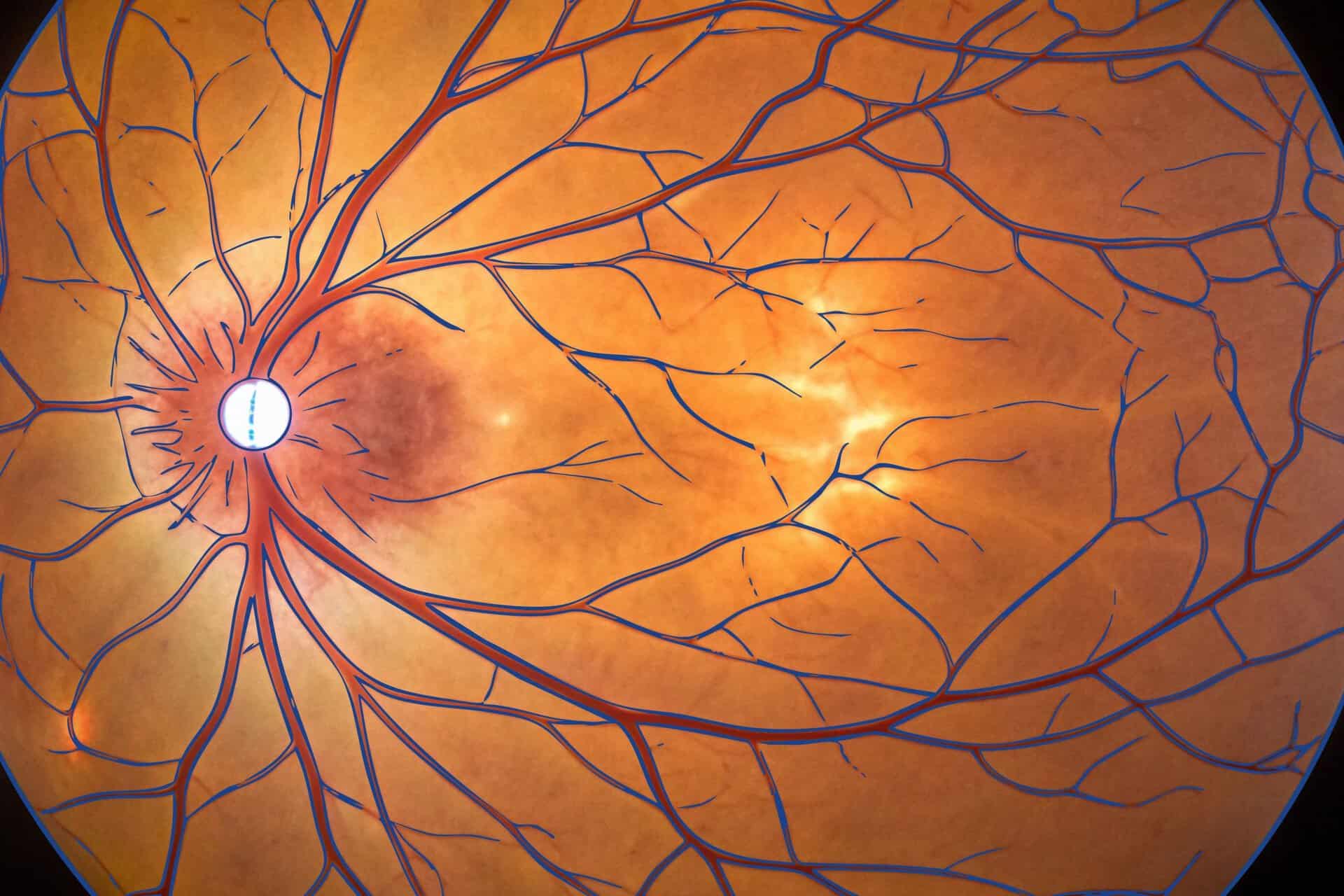 Retina y Vítreo - Fundación Oftalmológica Nacional en Bogotá | FUNDONAL